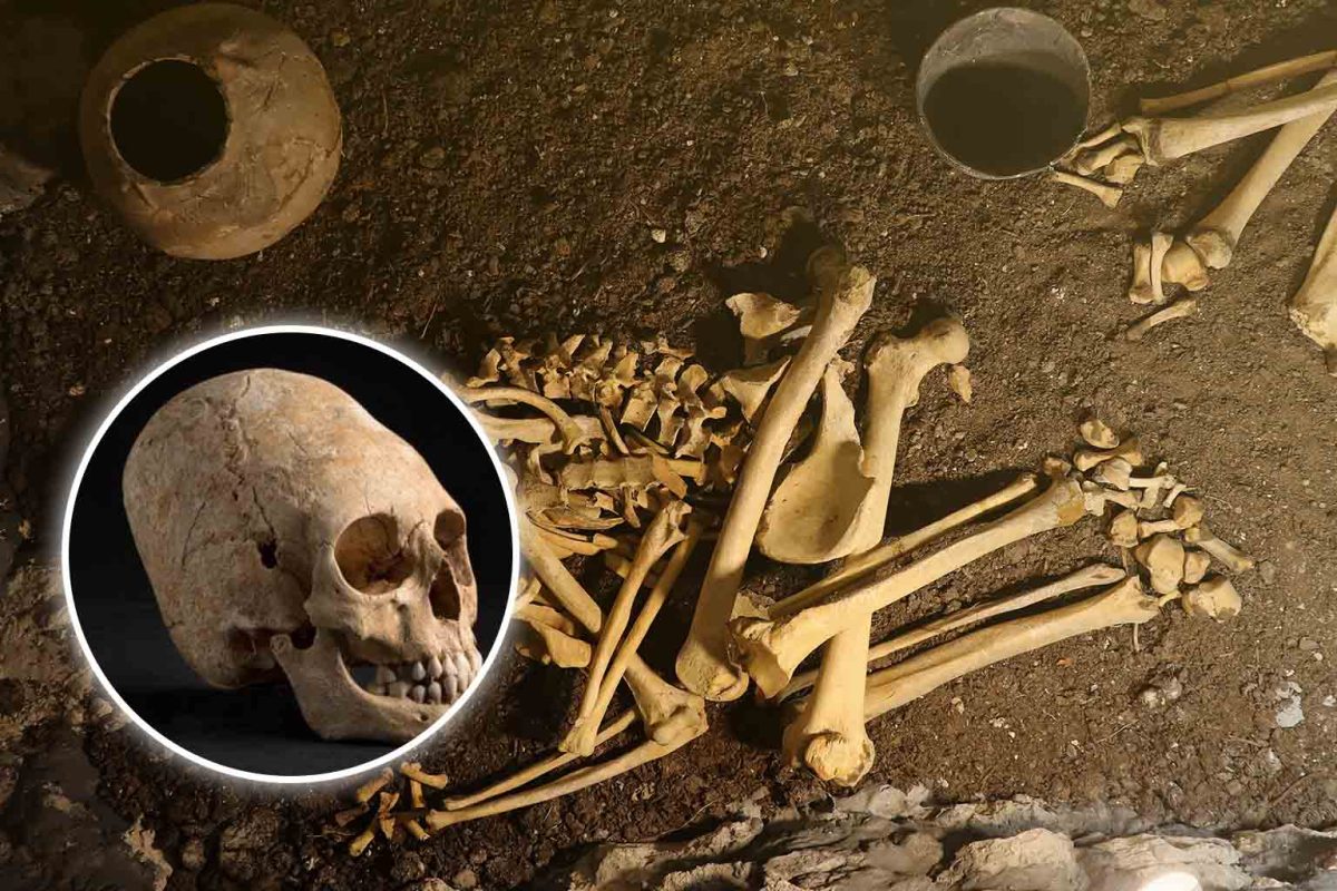 6,200-year-old girl’s skull reveals surprising truths about ancient ...